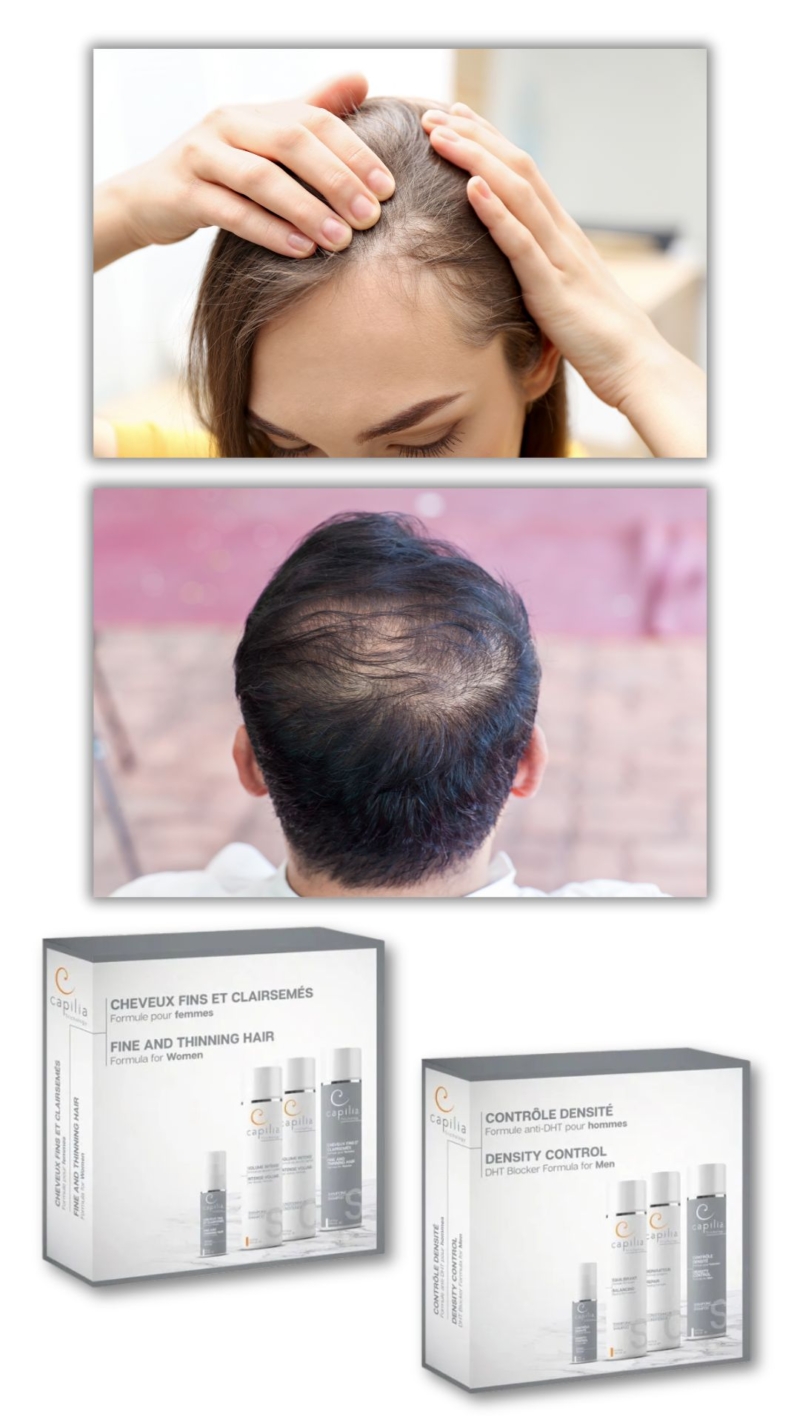 Hair Thinning – The Hair Society